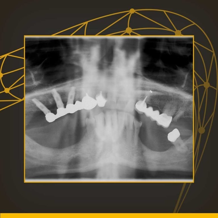 Radiografia panorâmica – RadioCenter Curitiba